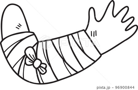 Hand Drawn splint arm illustrationのイラスト素材 [96900844] - PIXTA