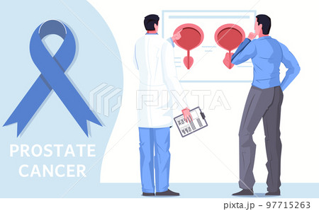 Cancer Prostate Flat Posterのイラスト素材 [97715263] - PIXTA