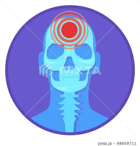 Headache round icon. Migraine symbol. Head painのイラスト素材 [98609711] - PIXTA