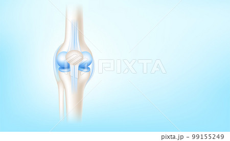 Knee joint with healthy cartilage front on blue...のイラスト素材 [99155249 ...