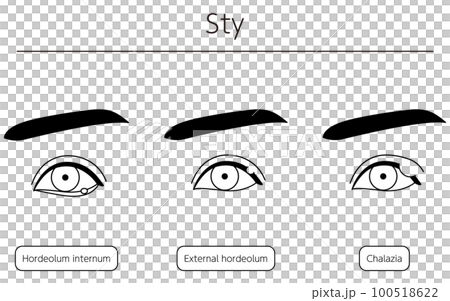 Medical illustration, line drawing illustration... - Stock Illustration ...