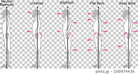 Standing posture evaluation classification English - Stock Illustration ...