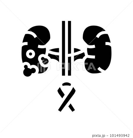 kidney cancer glyph icon vector illustrationのイラスト素材 [101493942] - PIXTA