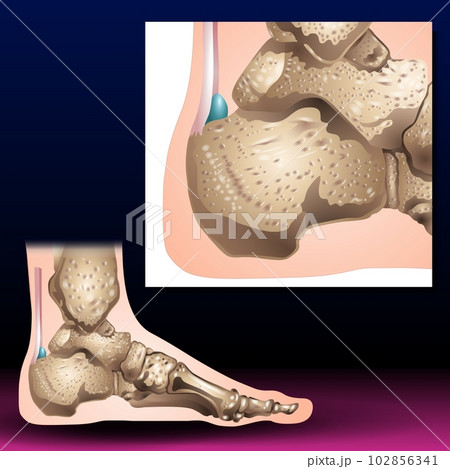 Toe Boneのイラスト素材 [102856341] - PIXTA