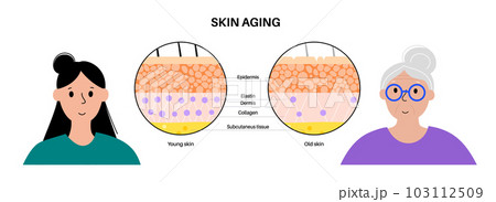 Skin aging posterのイラスト素材 [103112509] - PIXTA