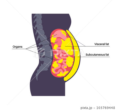 Visceral fat diagramのイラスト素材 [103769448] - PIXTA
