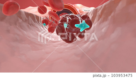 A blood clot is red blood cells that stick...のイラスト素材 [103953475] - PIXTA