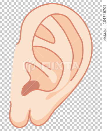 Cleft ear ear deformity Ear formation Medical care - Stock Illustration ...