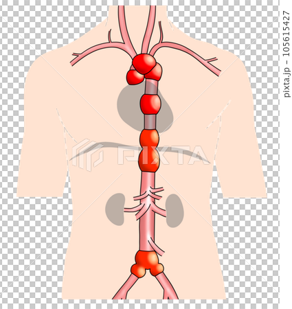 Simple aorta schematic from neck to waist - Stock Illustration ...