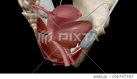 The internal urethral sphincter regulates...のイラスト素材 [106747387] - PIXTA