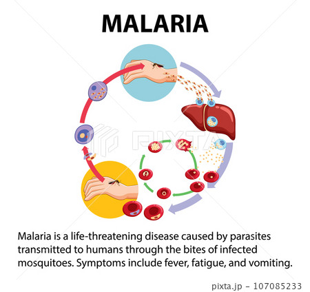 Life Cycle of Malaria Parasite: A Visual Guideのイラスト素材 [107085233] - PIXTA
