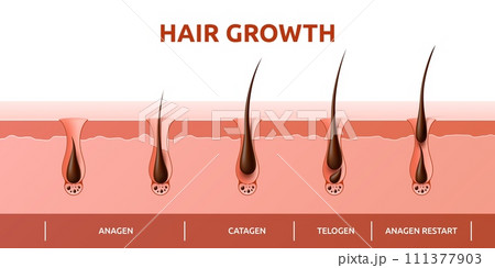 Hair growth cycle of follicles phase diagram...のイラスト素材 [111377903] - PIXTA