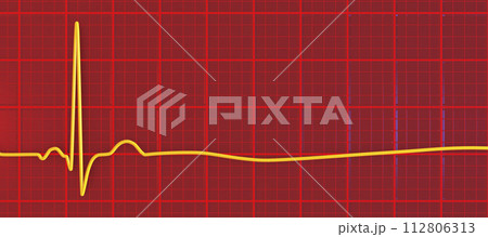 ECG in asystole, 3D illustrationのイラスト素材 [112806313] - PIXTA
