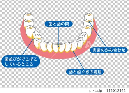 Areas where plaque is likely to remain Brushing... - Stock Illustration ...