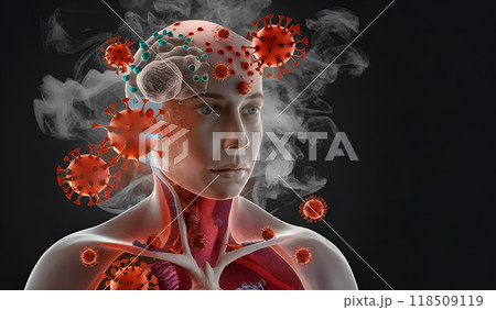 human head with torso attacked coronaviruses...のイラスト素材 [118509119] - PIXTA