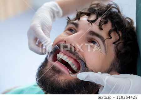 Bearded man patient during treatment procedure...の写真素材 [119264428] - PIXTA
