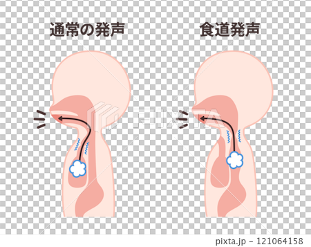 食道発声と通常の発声の仕組みのイラストのイラスト素材 [121064158] - PIXTA