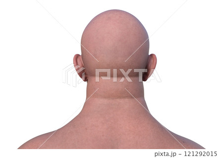 A man's hairless head from back view, 3D...のイラスト素材 [121292015] - PIXTA