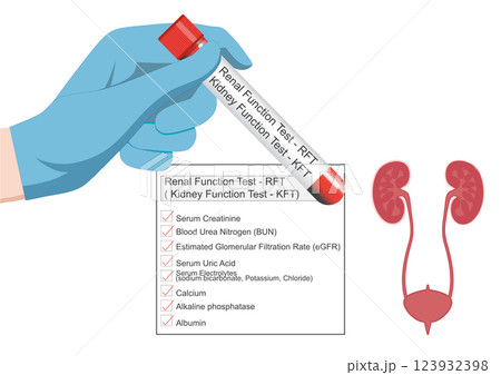 Kidney function tests (renal function tests)のイラスト素材 [123932398] - PIXTA
