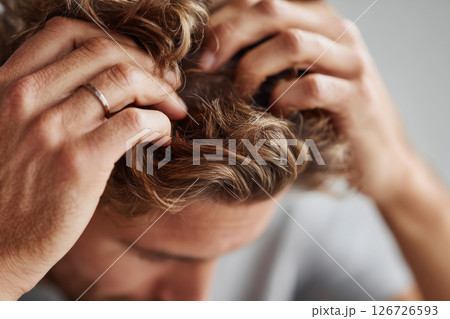 Close-up of man massaging his scalp with...のイラスト素材 [126726593] - PIXTA