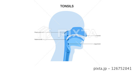 Tonsils anatomical posterのイラスト素材 [126752841] - PIXTA