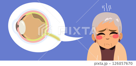 Senior Woman with Retinal Detachment Eye...のイラスト素材 [126857670] - PIXTA