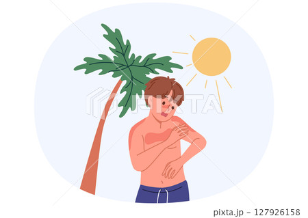 Boy received sunburn due to ultraviolet allergy...のイラスト素材 [127926158 ...