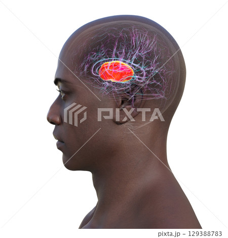 Internal capsule, 3D illustration. Highlighted...のイラスト素材 [129388783 ...