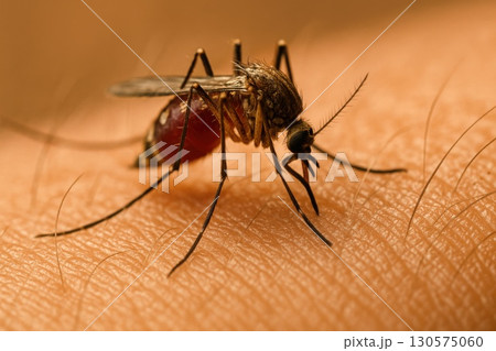 Mosquito Biting Human Skin Close-Up Insect...のイラスト素材 [130575060] - PIXTA