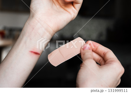 A person applies a medical plaster to a burn on...の写真素材 [131999511] - PIXTA