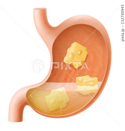 Human Stomach with cheese. The stomach digests...のイラスト素材 [132788945 ...